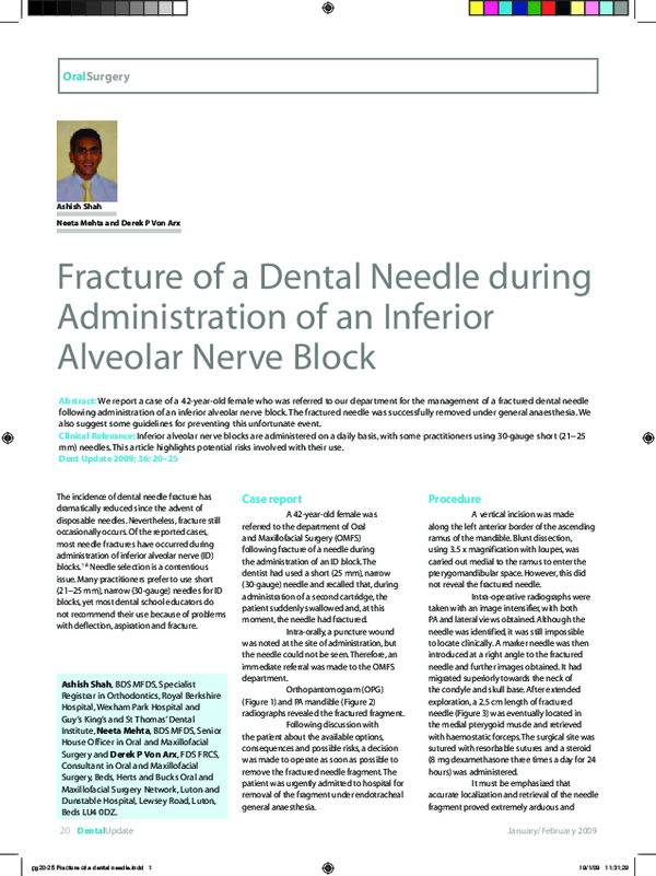 (PDF) Fracture of a dental needle during administration of an inferior ...