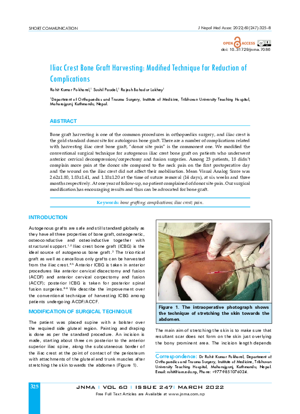 (PDF) Iliac Crest Bone Graft Harvesting: Modified Technique for ...