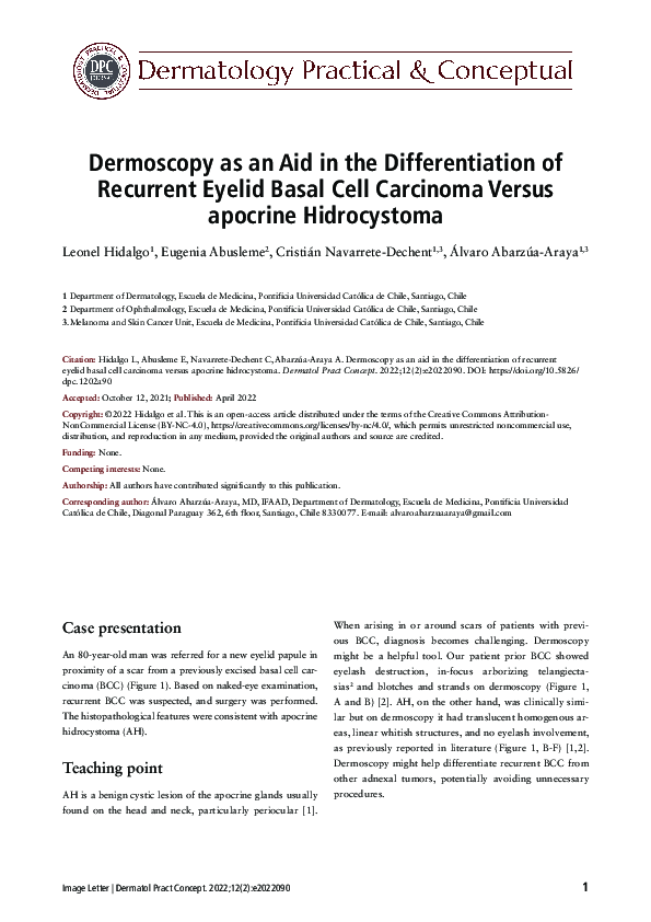 (PDF) Dermoscopy as an aid in the differentiation of recurrent eyelid ...