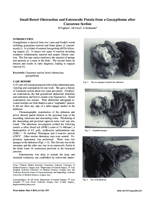 (PDF) Small Bowel Obstruction and Enterocolic Fistula from a ...