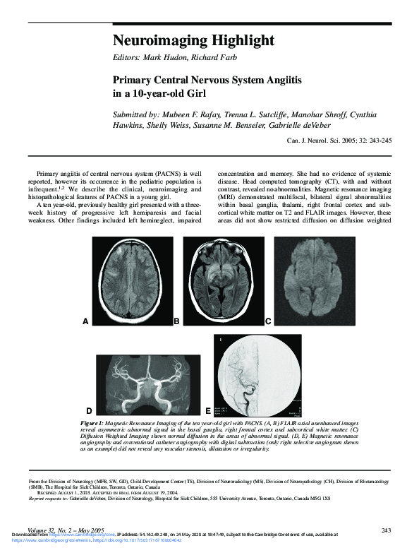 (PDF) Primary Central Nervous System Angiitis in a 10-year-old Girl