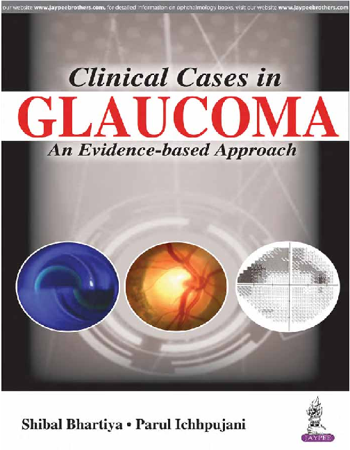 (PDF) Clinical Cases in Glaucoma: An Evidence-based Approach