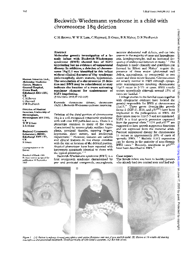 (PDF) Beckwith-Wiedemann syndrome in a child with chromosome 18q ...