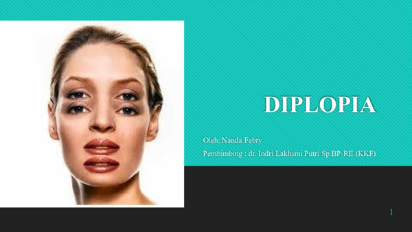 (PPT) DIPLOPIA