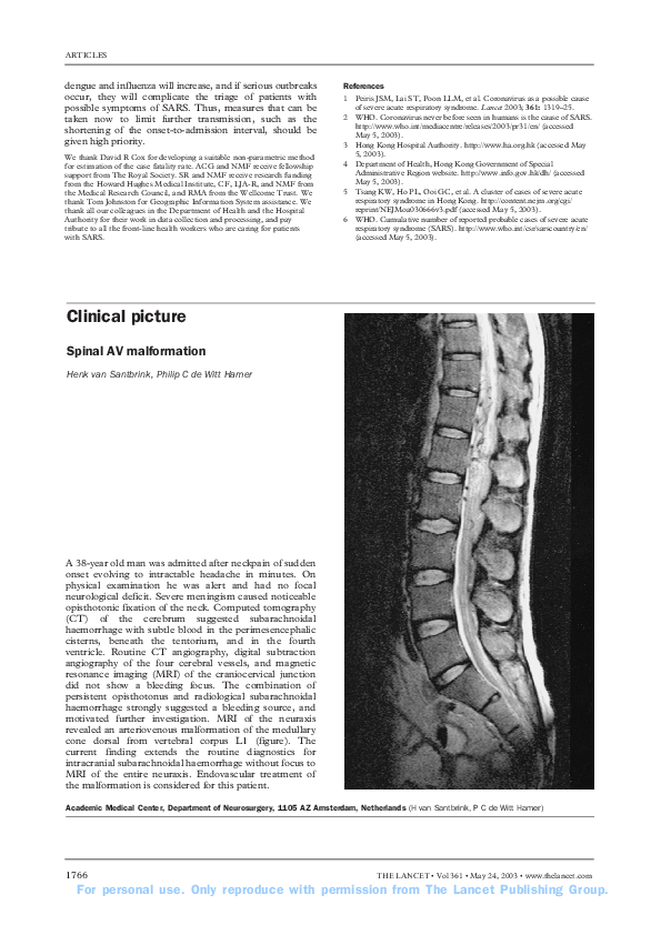 (PDF) Spinal AV malformation