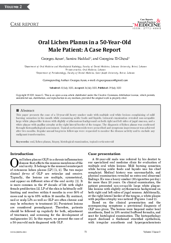 (PDF) Oral Lichen Planus in a 50-Year-Old Male Patient: A Case Report