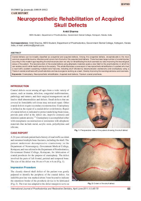 (PDF) Neuroprosthetic Rehabilitation of Acquired Skull Defects