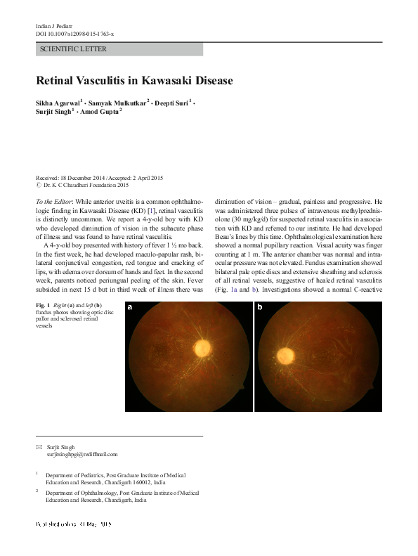 (PDF) Retinal Vasculitis in Kawasaki Disease