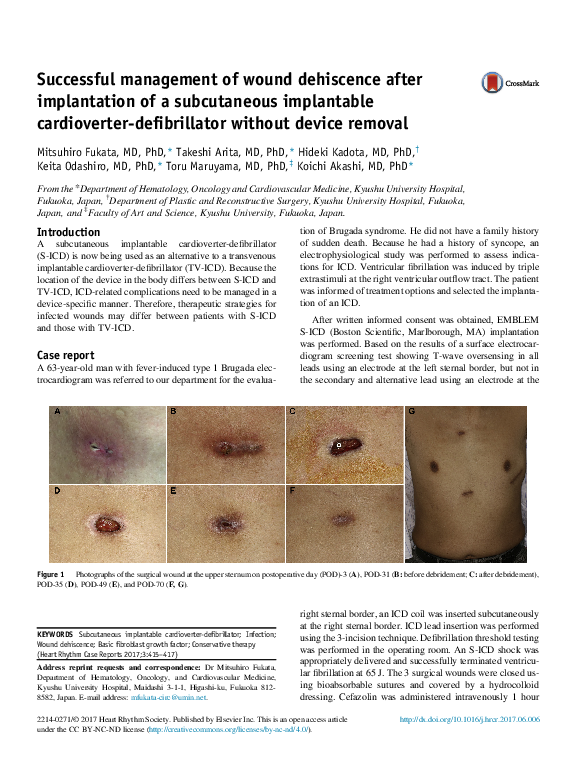(PDF) Successful management of wound dehiscence after implantation of a ...