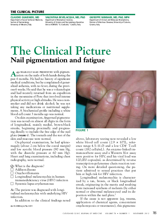 (PDF) Nail pigmentation and fatigue