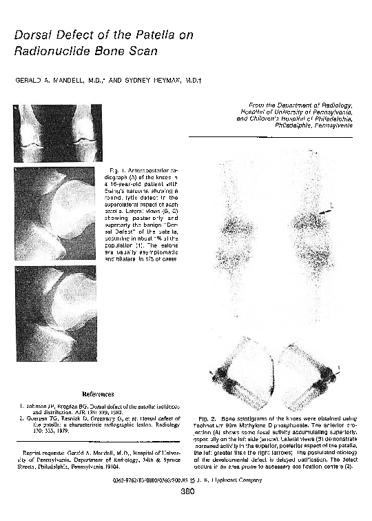 (PDF) Dorsal Defect of the Patella on Radionuclide Bone Scan | Gerald A ...