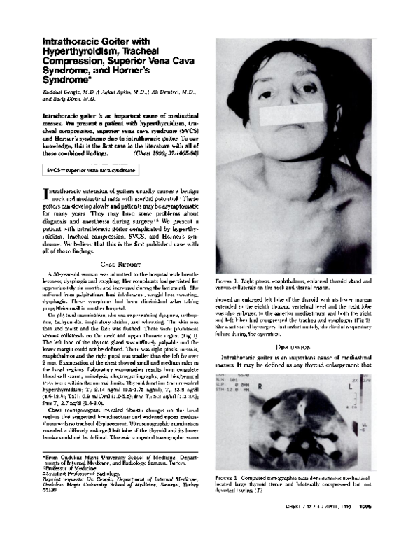(PDF) Intrathoracic goiter with hyperthyroidism, tracheal compression ...