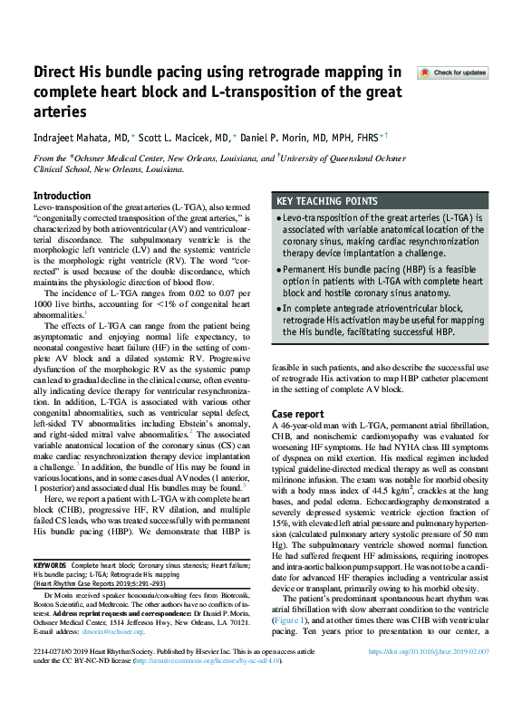 (PDF) Direct His bundle pacing using retrograde mapping in complete ...
