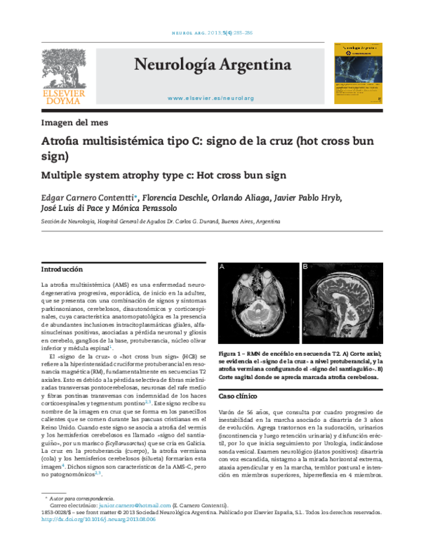 (PDF) Atrofia multisistémica tipo C: signo de la cruz (hot cross bun sign)