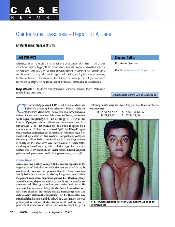 (PDF) Cleidocranial Dysplasia - Report of A Case
