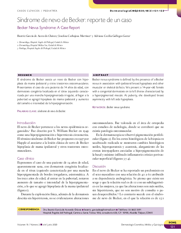 (PDF) Síndrome de nevo de Becker: reporte de un caso | Cecilia Gallegos ...
