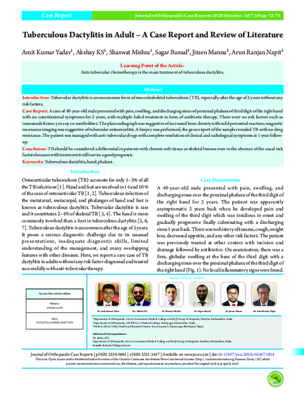 Tuberculous Dactylitis in Adult – A Case Report and Review of Literature