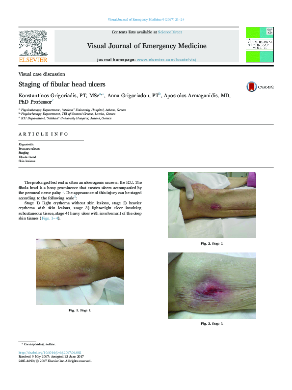 (PDF) Staging of fibular head ulcers | Kostas Grigoriadis - Academia.edu
