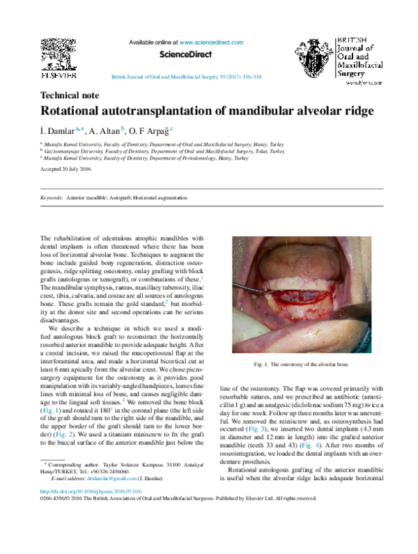(PDF) Rotational autotransplantation of mandibular alveolar ridge
