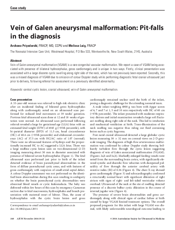 (PDF) Vein of Galen aneurysmal malformation: Pit-falls in the diagnosis