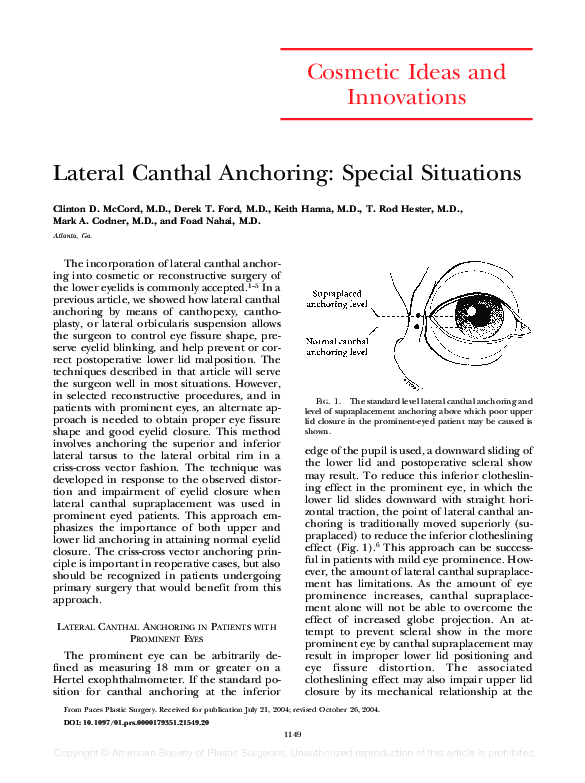 (PDF) Lateral Canthal Anchoring: Special Situations | Derek Ford ...