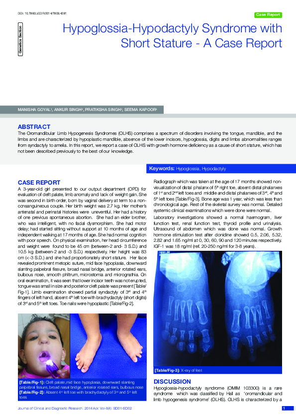 (PDF) Hypoglossia-hypodactyly syndrome with short stature - a case report