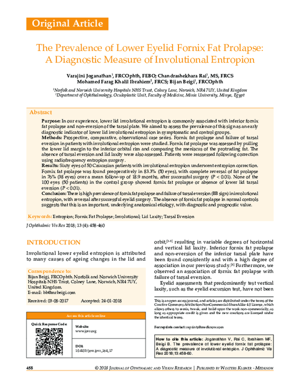 (PDF) The prevalence of lower eyelid fornix fat prolapse: A diagnostic ...
