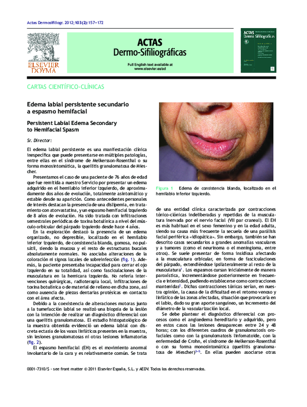 (PDF) Edema labial persistente secundario a espasmo hemifacial | eva ...