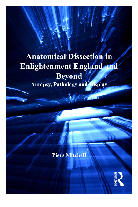 (PDF) Patients, Anatomists and Resurrection Men: Archaeological ...