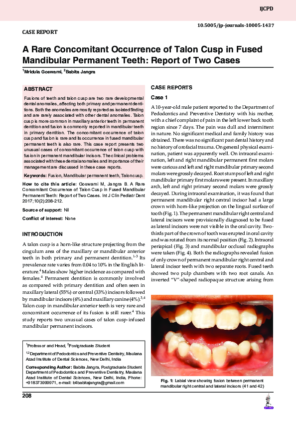 (PDF) A Rare Concomitant Occurrence of Talon Cusp in Fused Mandibular ...