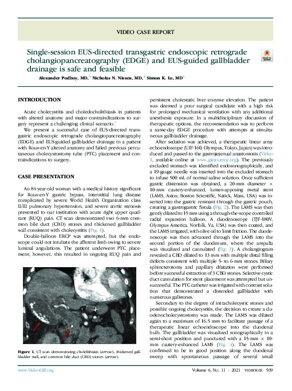 (PDF) Single-session EUS-directed transgastric endoscopic retrograde ...