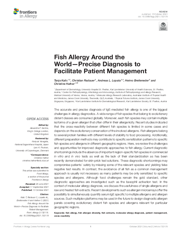 (PDF) Design of Brain Activity Measurement for Brain ECVT Data ...