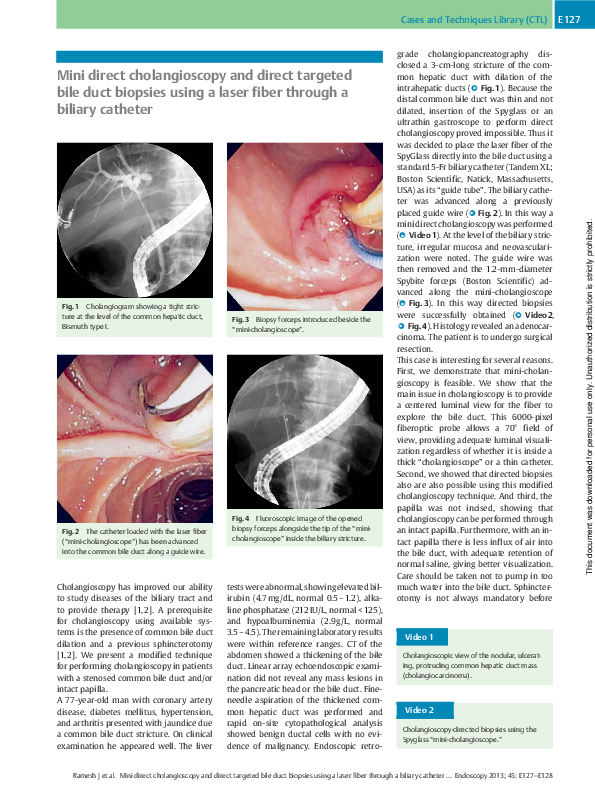 (PDF) Mini direct cholangioscopy and direct targeted bile duct biopsies ...