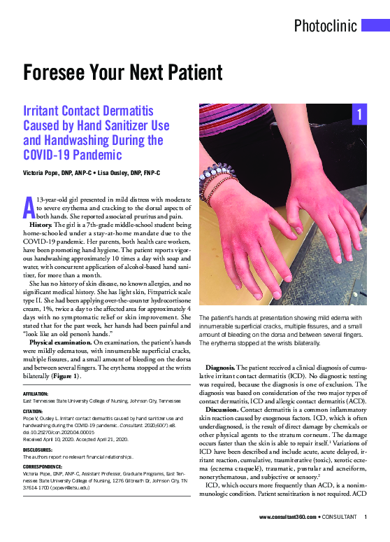 (PDF) Irritant Contact Dermatitis Caused by Hand Sanitizer Use and ...