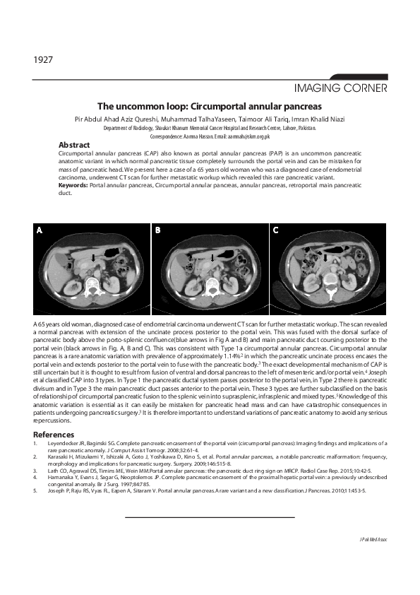 (PDF) The uncommon loop: Circumportal annular pancreas