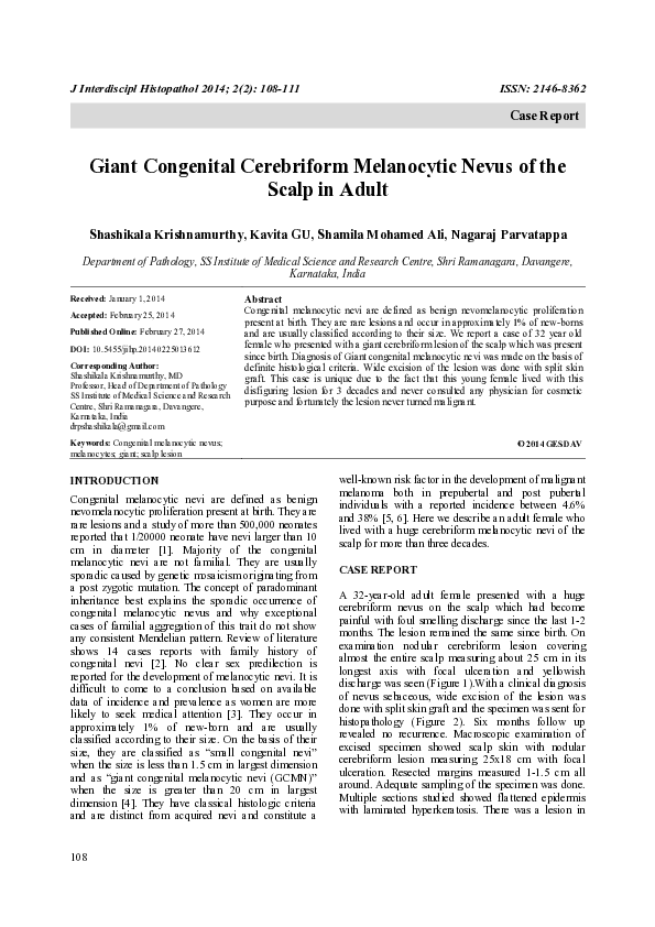 (PDF) Giant Congenital Cerebriform Melanocytic Nevus of the Scalp in Adult