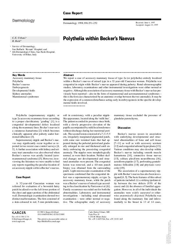 (PDF) Polythelia within Becker’s Naevus