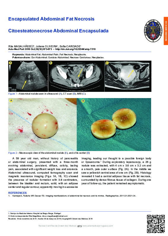 (PDF) Encapsulated Abdominal Fat Necrosis | Sofia Caridade - Academia.edu