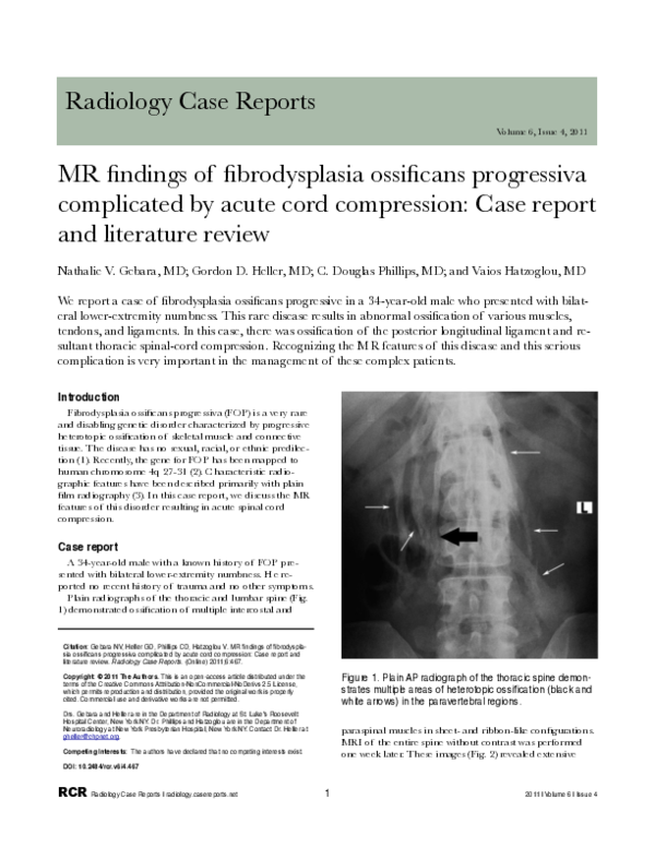 (PDF) Fibrodysplasia ossificans progressiva: MR findings of FOP ...