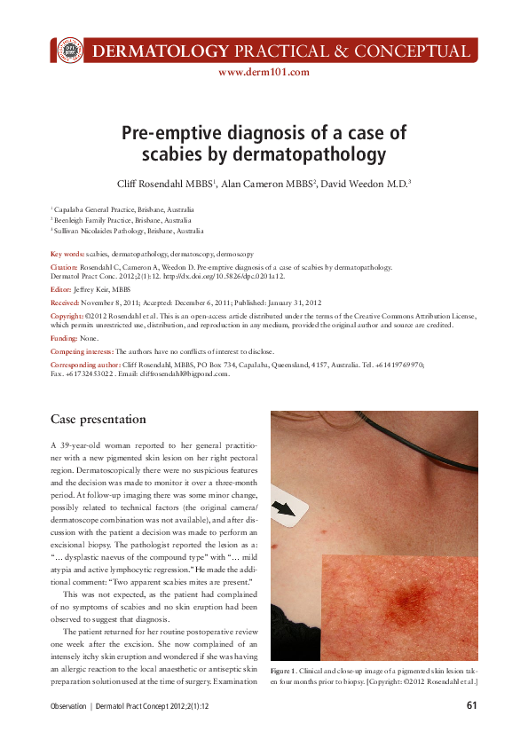 (PDF) Pre-emptive diagnosis of a case of scabies by dermatopathology ...