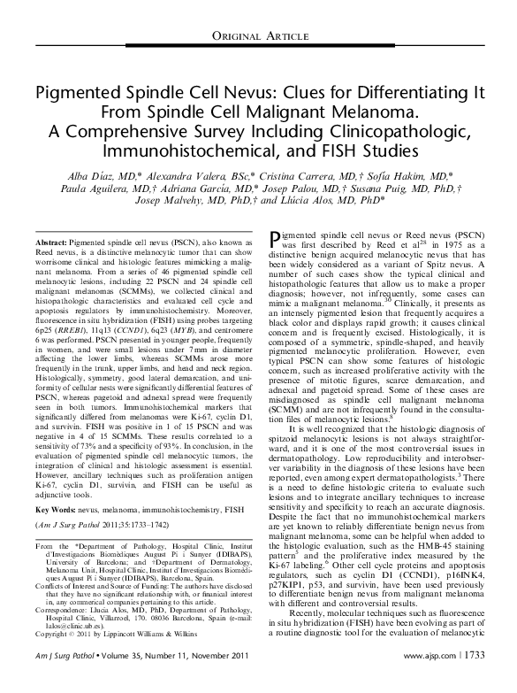 (PDF) Pigmented Spindle Cell Nevus
