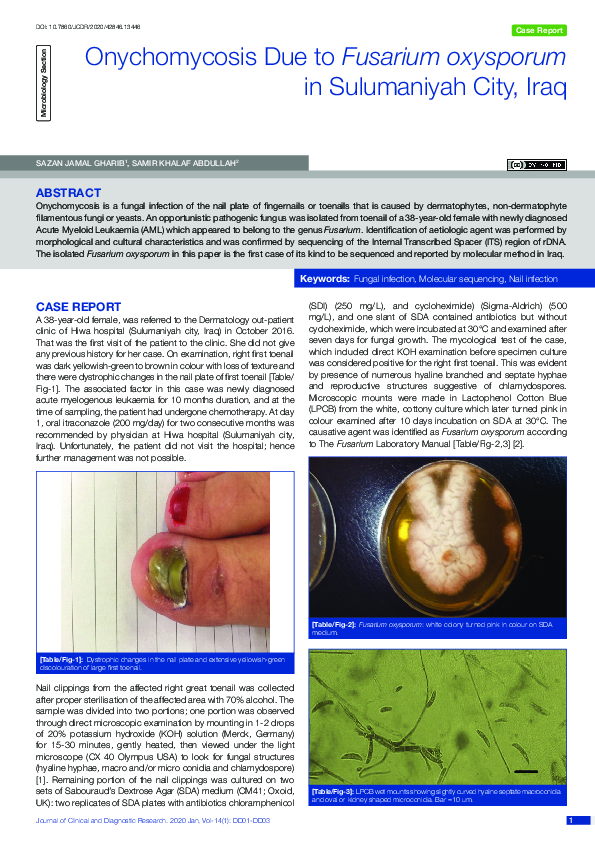 (PDF) Onychomycosis Due to Fusarium oxysporum in Sulumaniyah City, Iraq ...