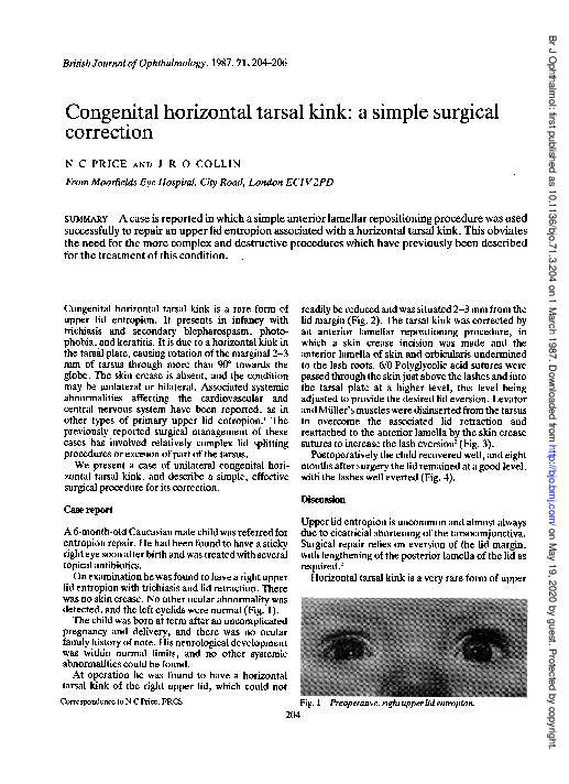 (PDF) Congenital horizontal tarsal kink: a simple surgical correction ...