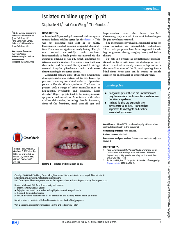 (PDF) Isolated midline upper lip pit