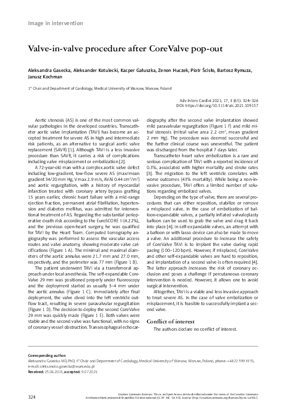 (PDF) Valve-in-valve procedure after CoreValve pop-out