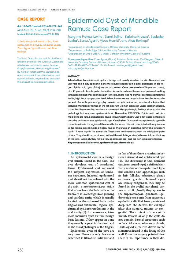 Pdf Epidermoid Cyst Of Mandible Ramus Case Report Vjosa Hamiti