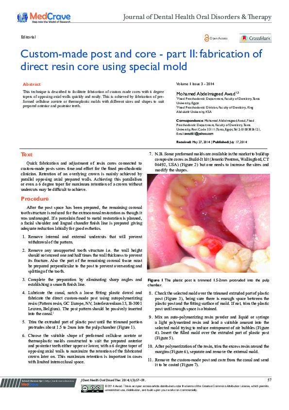(PDF) Custom-Made Post and Core - Part II: Fabrication of Direct Resin ...