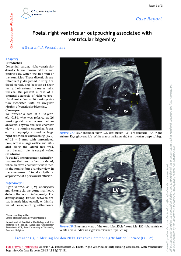 (PDF) Foetal right ventricular outpouching associated with ventricular ...