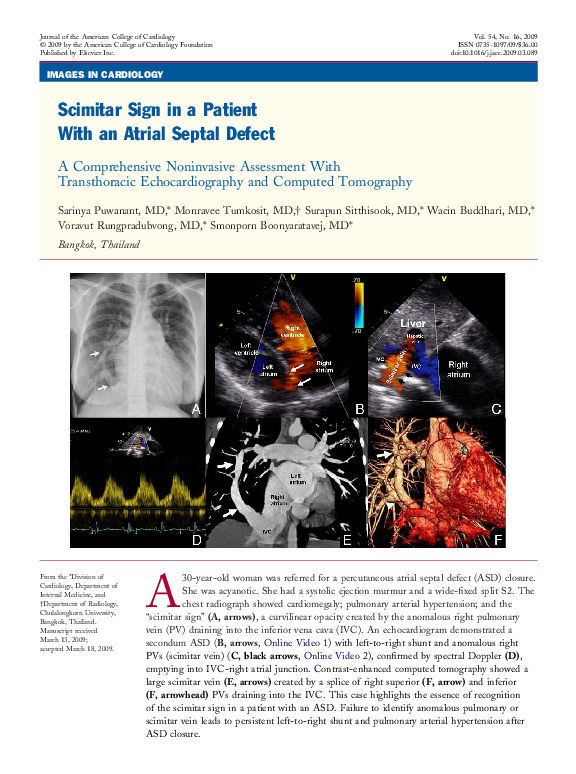 (PDF) Scimitar Sign in a Patient With an Atrial Septal Defect | Voravut ...