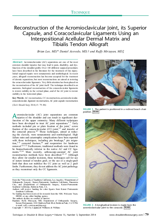 (PDF) Reconstruction of the Acromioclavicular Joint, its Superior ...